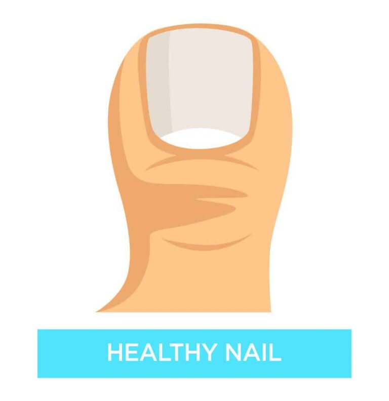 Nail Fungus Tips For Prevention And Hygiene